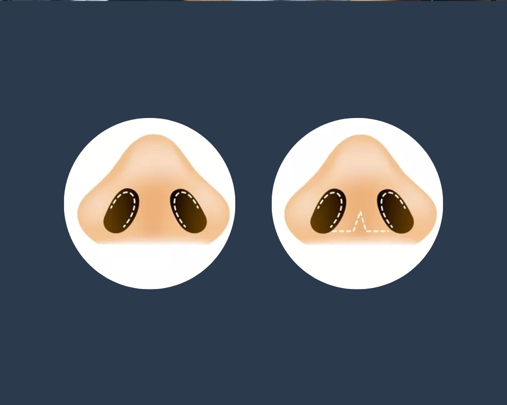 O que é cirurgia Aberta e fechada? - Thomas Cito